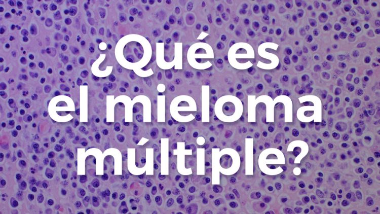¿Qué es el mieloma GMSI, indolente (asintomático/smoldering) y el MM ...